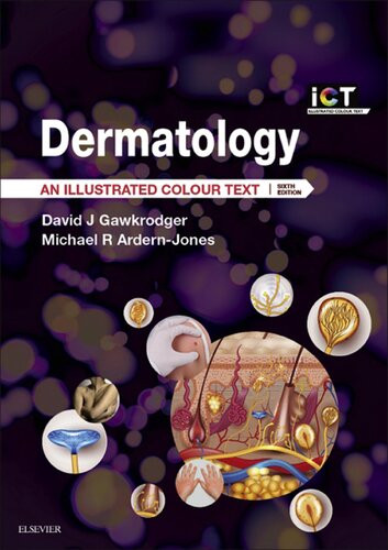 Ebook – Dermatology: An Illustrated Colour Text (PDF Instant Download) – Ebook Store
